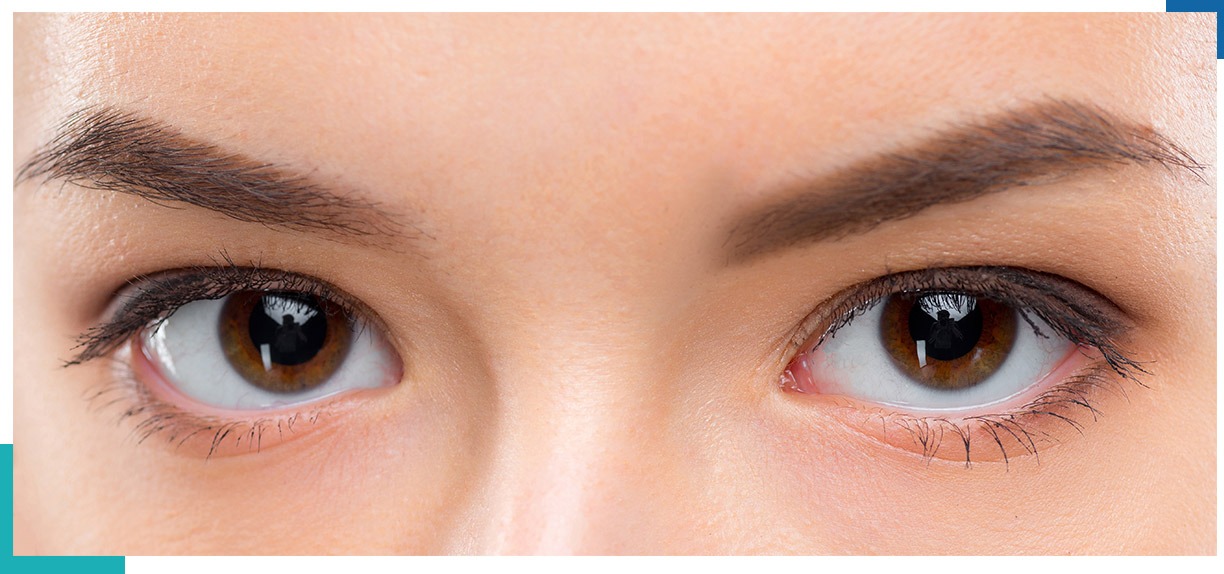 cejas - Clínicas Beiman - Jerez - Sevilla - Córdoba - Jaén - Granada ...